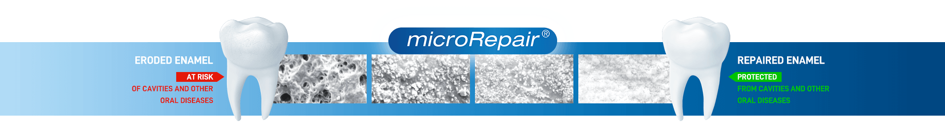 Biorepair - The only microRepair-based toothpaste with no fluorine ...
