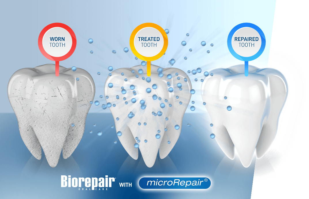 Biorepair - Enamel is a translucent white fabric, the most rigid and ...